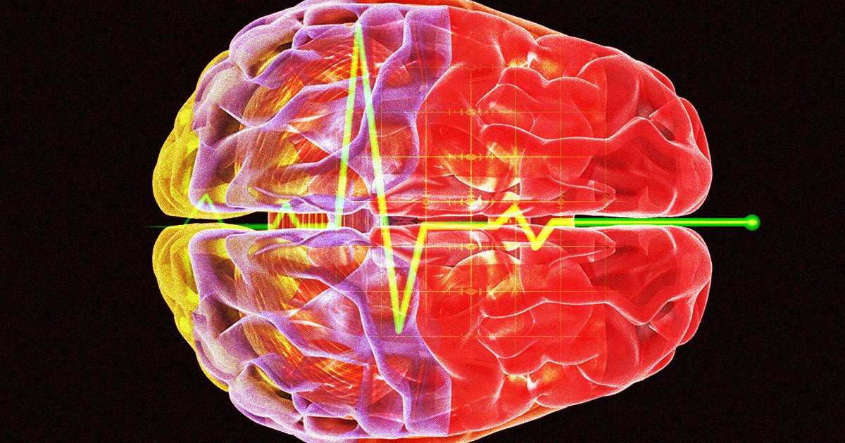 Scientists Recorded The Brain Activity Of A Person As They Died And