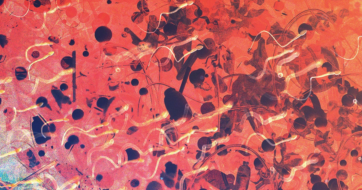 Scientists Found Microplastics in Every Human Semen Sample They Examined Scientists Found Microplastics in Every Human Semen Sample They Examined